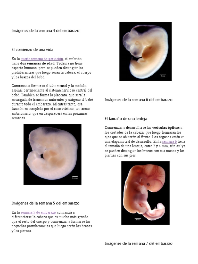 Imágenes de La Semana 4 Del Embarazo | PDF | El embarazo | Sistema digestivo humano
