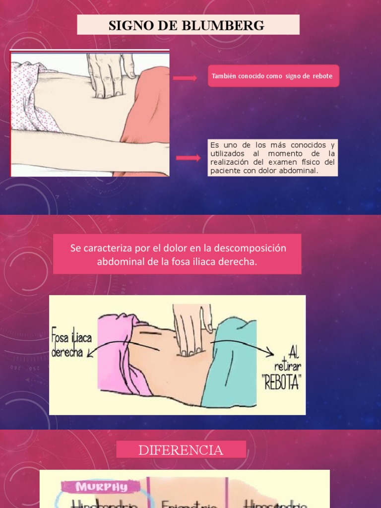 Signo de Blumberg | PDF