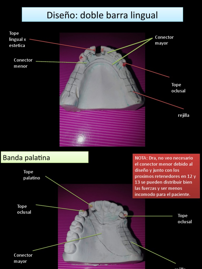 Diseño de PPR | PDF