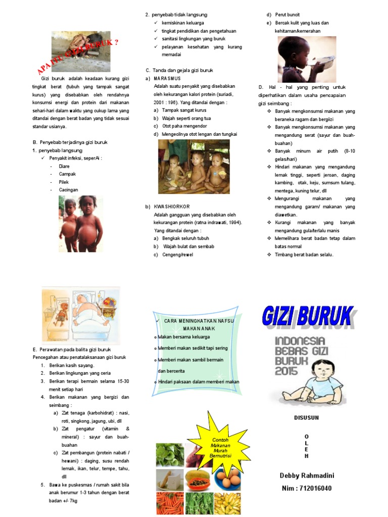 Leaflet Gizi Buruk | PDF