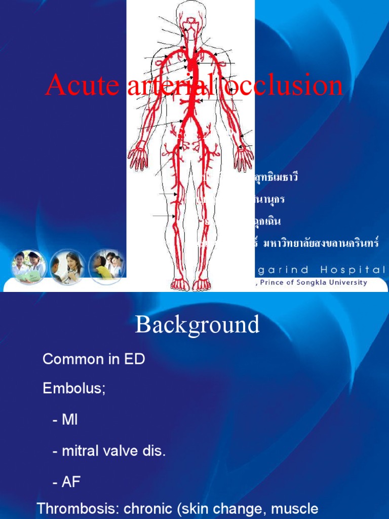 Acute Arterial Occlusion Overview | PDF | Pulse | Interventional Radiology
