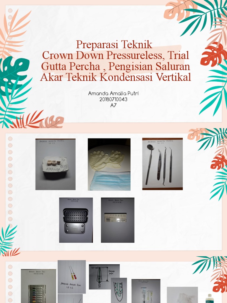 Preparasi Teknik Crown Down | PDF