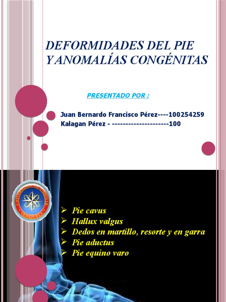 Deformidades Del Pie | PDF | Pie | Sistema musculoesquelético