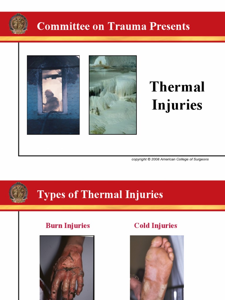 Committee On Trauma Presents: Thermal Injuries | PDF | Hypothermia | Burn