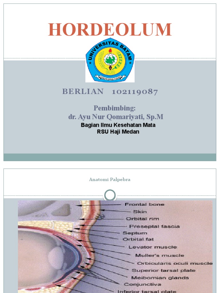 Hordeolum PPT Berin | PDF | Sains & Matematika