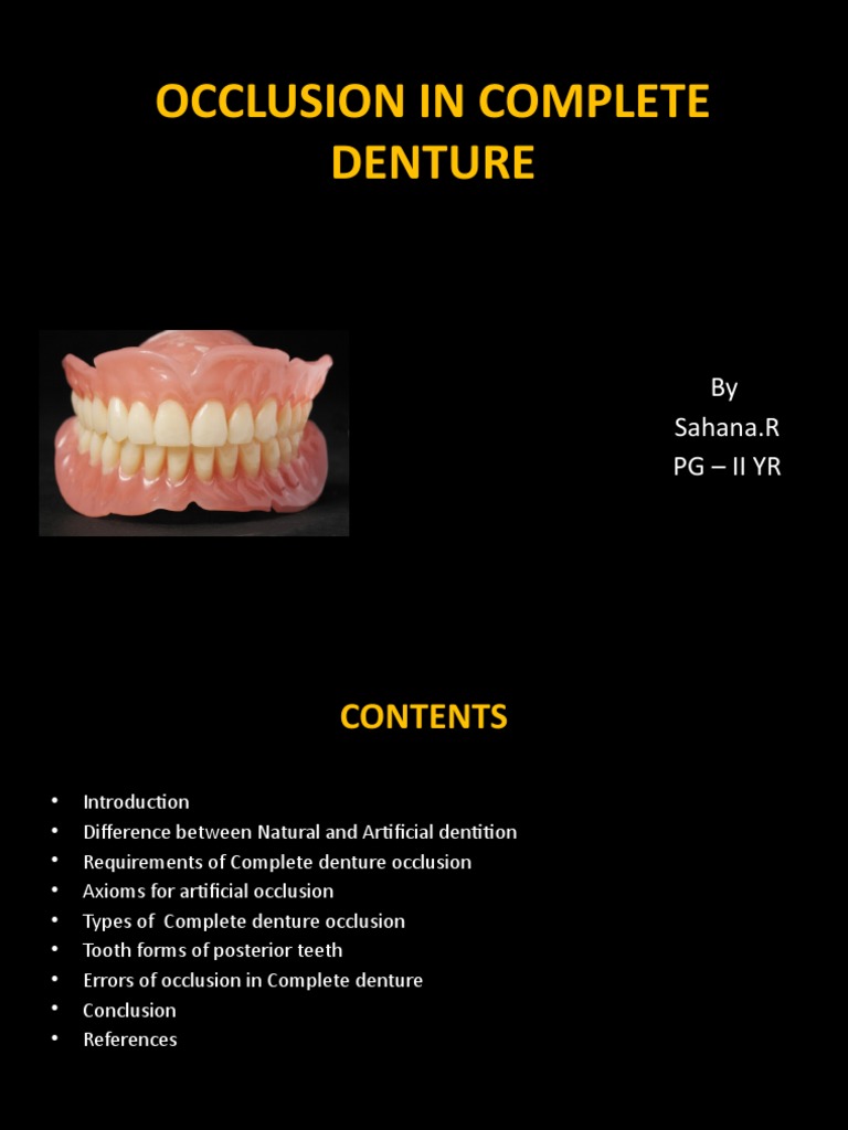 Occlusion in Complete Denture | PDF | Dentures | Human Head And Neck