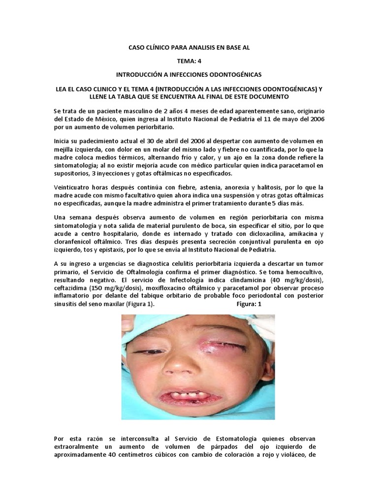 Absceso periorbitario secundario a abscesos dentoalveolares crónicos en ...