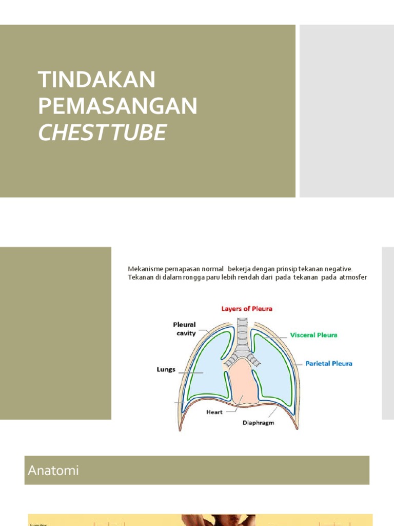 Prosedur Pemasangan Chest Tube | PDF