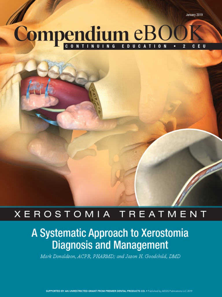 A Systematic Approach To Xerostomia Diagnosis and Management | PDF ...