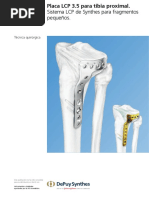Placa Philos Técnica Cirúrgica | PDF | Tornillo | Cirugía