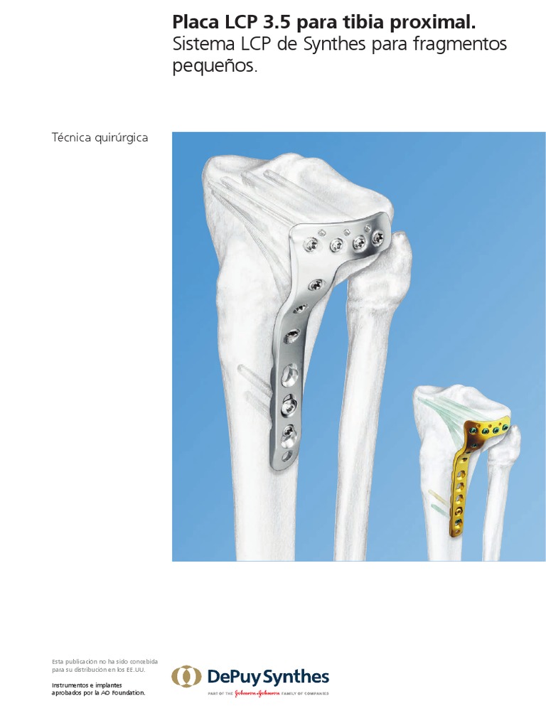 Placa Anatomica Proximal para Tibia 3.5 | PDF | Tornillo | Hueso