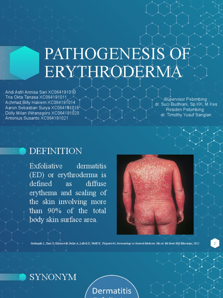 Erythroderma: Definition and Pathogenesis | PDF | Psoriasis | Dermatology