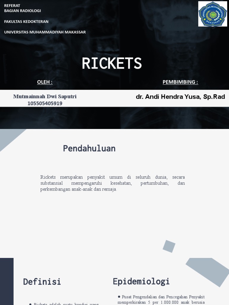 Rickets | PDF