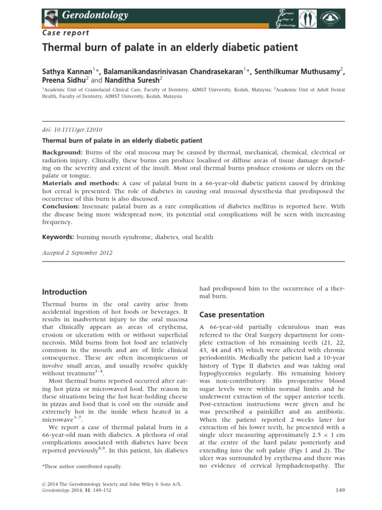 (Kannan Et Al., 2012) Thermal Burn of Palate in An Elderly Diabetic ...