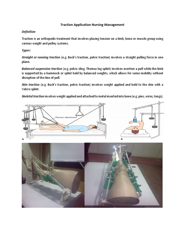Traction Application Nursing Management | PDF | Pelvis | Pain Management