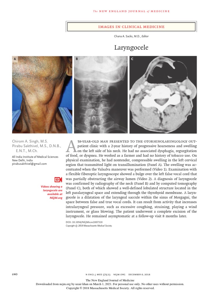 Laryngocele: Images in Clinical Medicine | PDF | Larynx | Medical ...