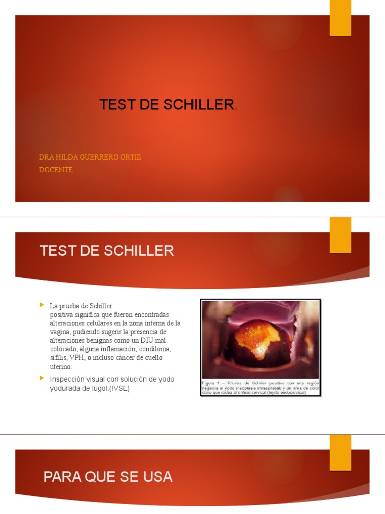 Test de Schiller: Dra Hilda Guerrero Ortiz Docente | PDF | Vagina | Color
