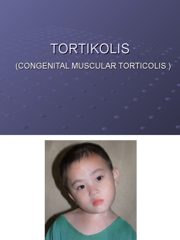 Tortikolis pada Anak: Definisi dan Terapi | PDF | Pengembangan Diri ...