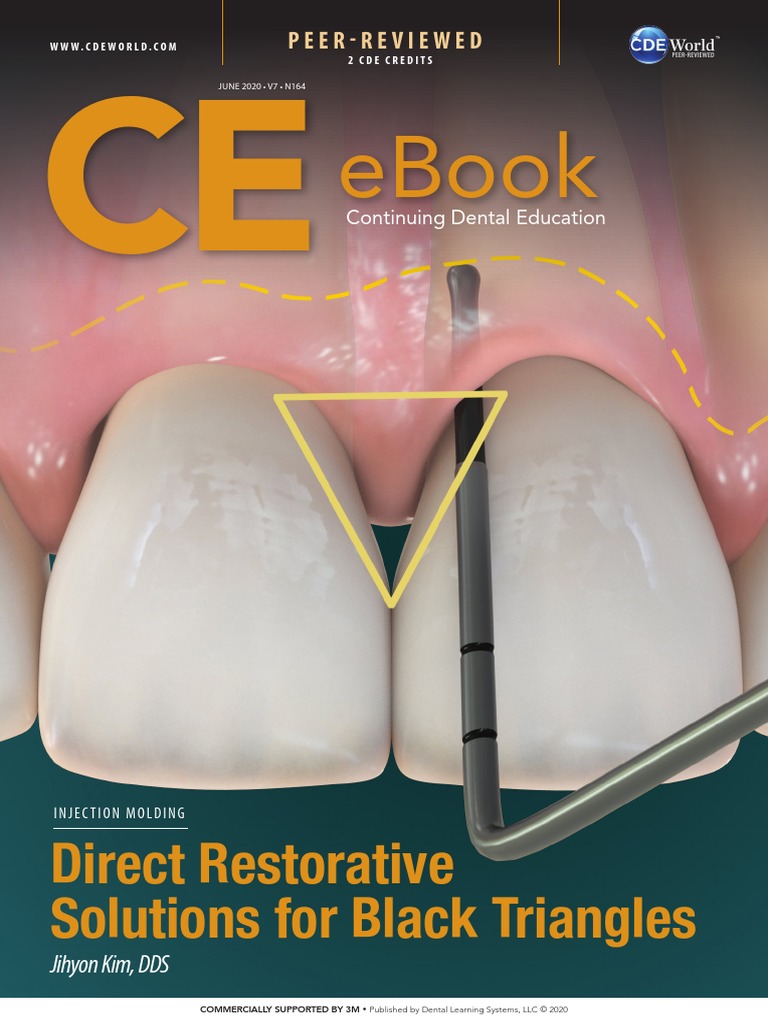 Direct Restorative Solutions For Black Triangles | PDF | Periodontology ...