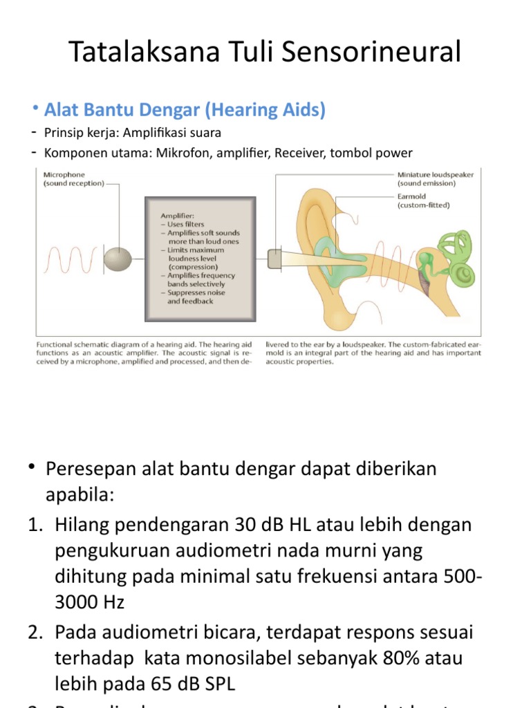 Tatalaksana Tuli Sensorineural | PDF | Kesehatan Holistik