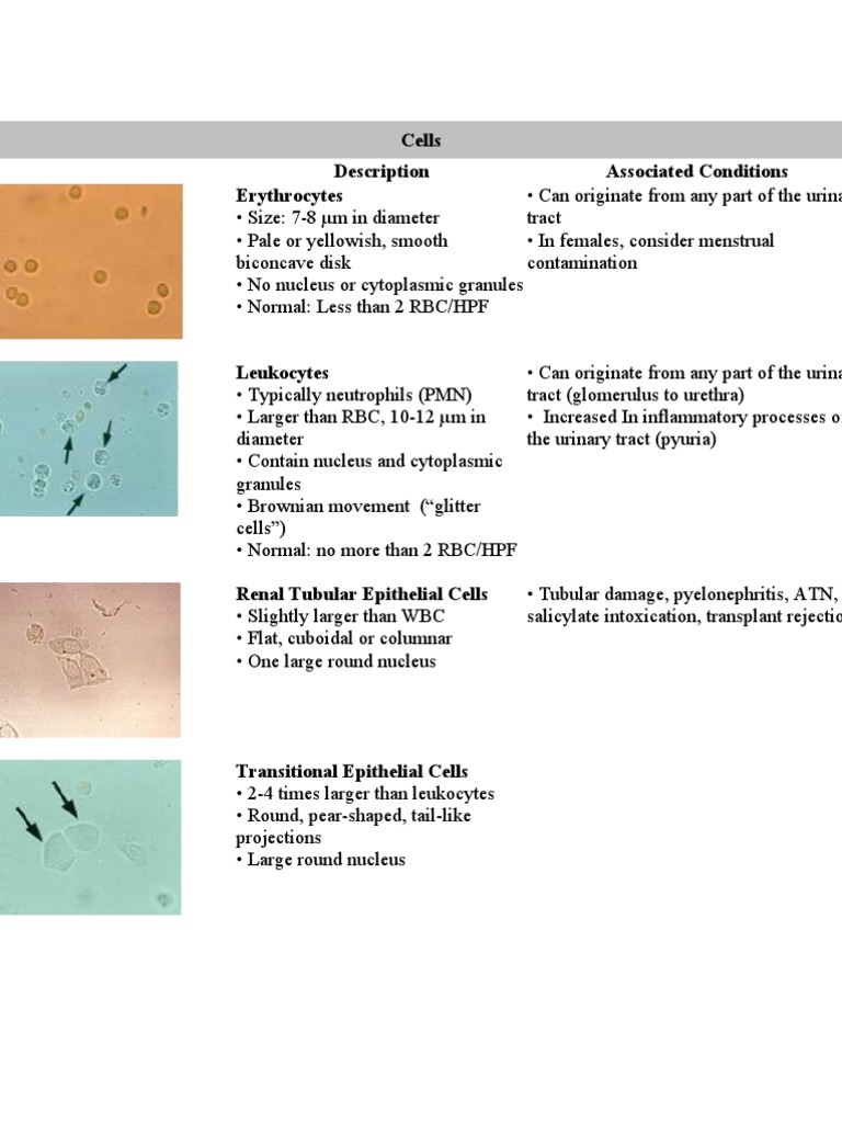 Urine Sediments | Anatomy | Medical Specialties