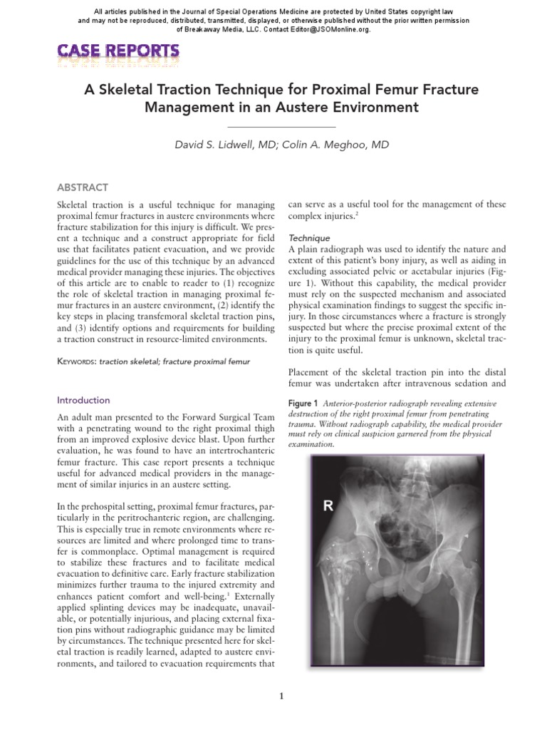 A Skeletal Traction Technique For Proximal Femur Fracture Management in ...