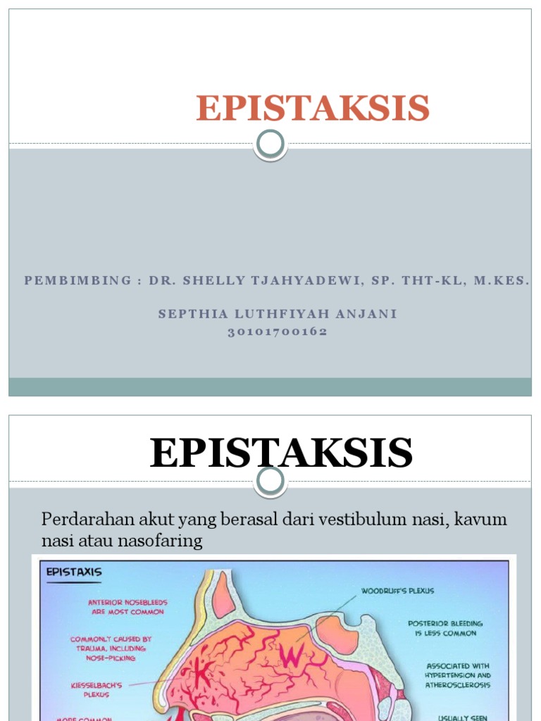 EPISTAKSIS | PDF