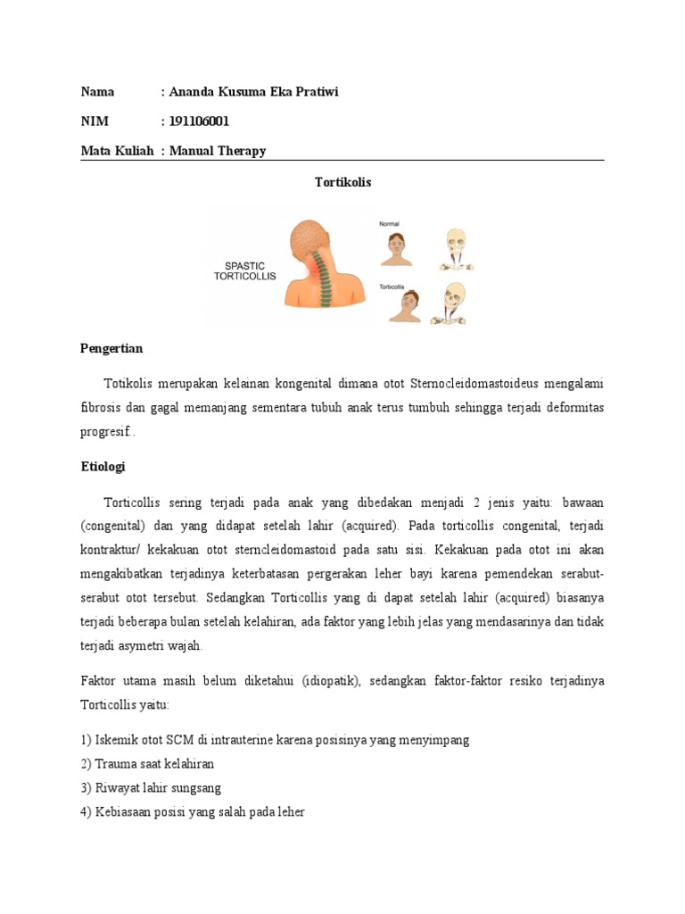 Tortikolis: Gejala dan Intervensi | PDF