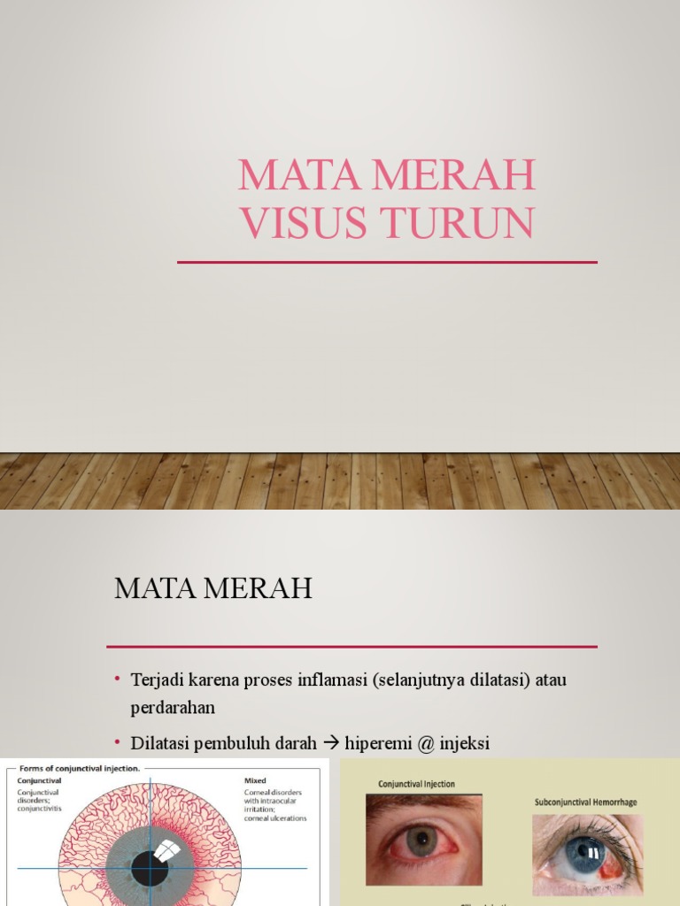 Mata Merah Visus Turun | PDF | Sains & Matematika