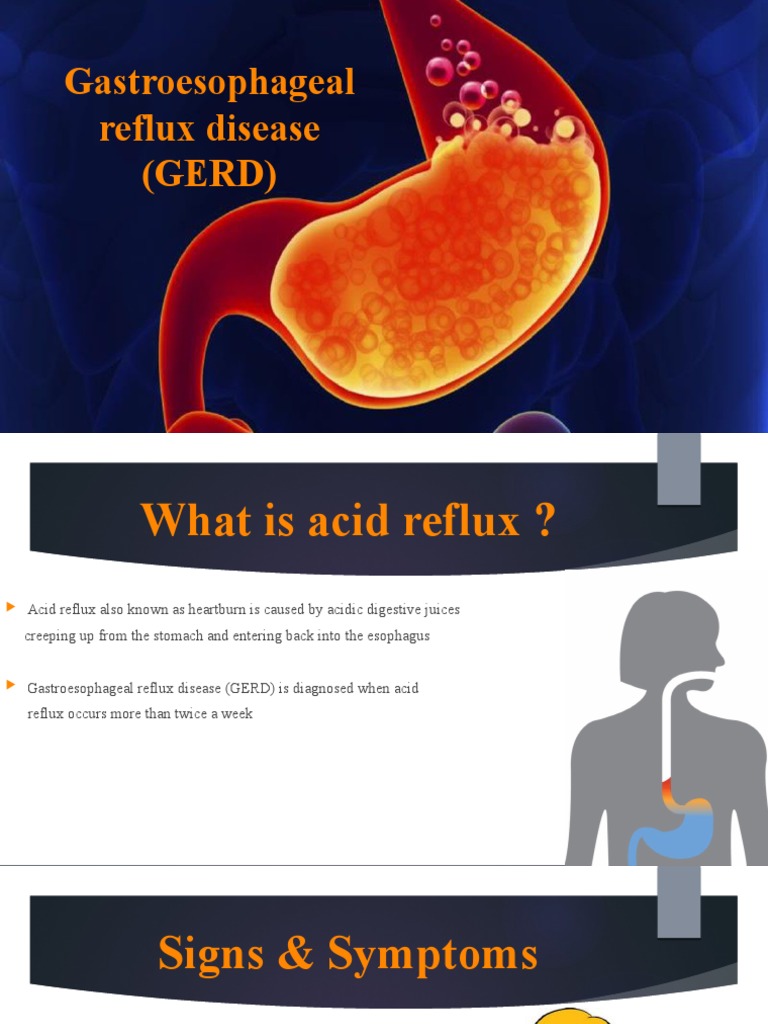 Public Education Acid Reflux | PDF | Gastroesophageal Reflux Disease ...