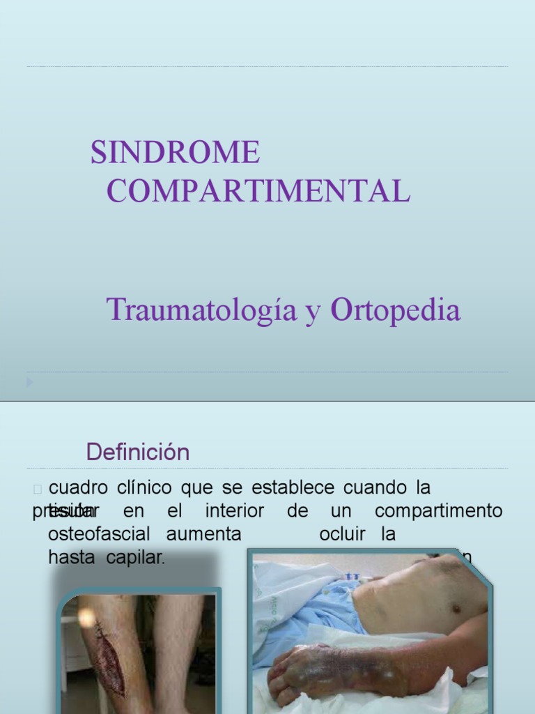Sindrome Compartimental | PDF | Medicina | Enfermedades y trastornos