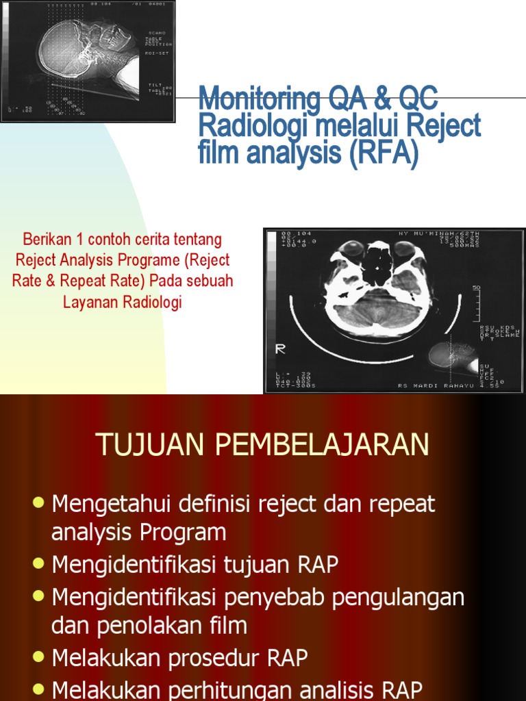 Monitoring QA QC Melalui Reject Film Analysis | PDF