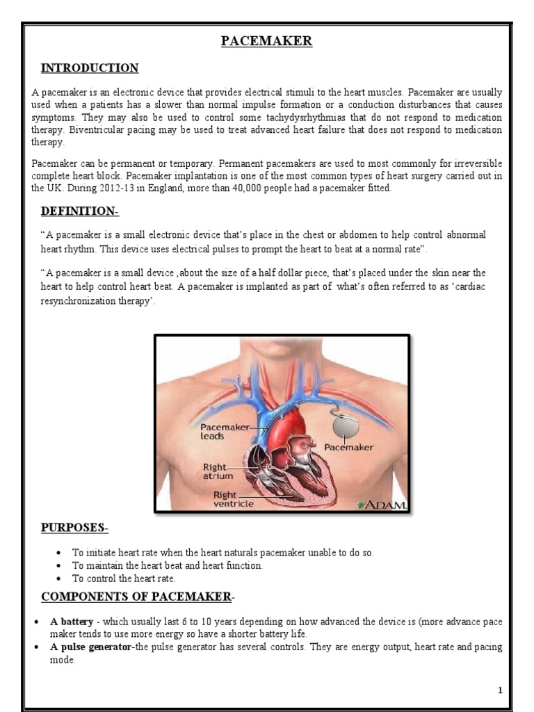 PACEMAKER | PDF | Artificial Cardiac Pacemaker | Heart