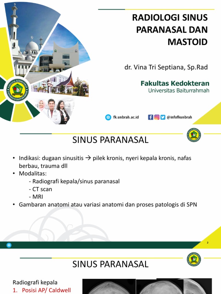 Radiologi Sinus & Mastoid | PDF