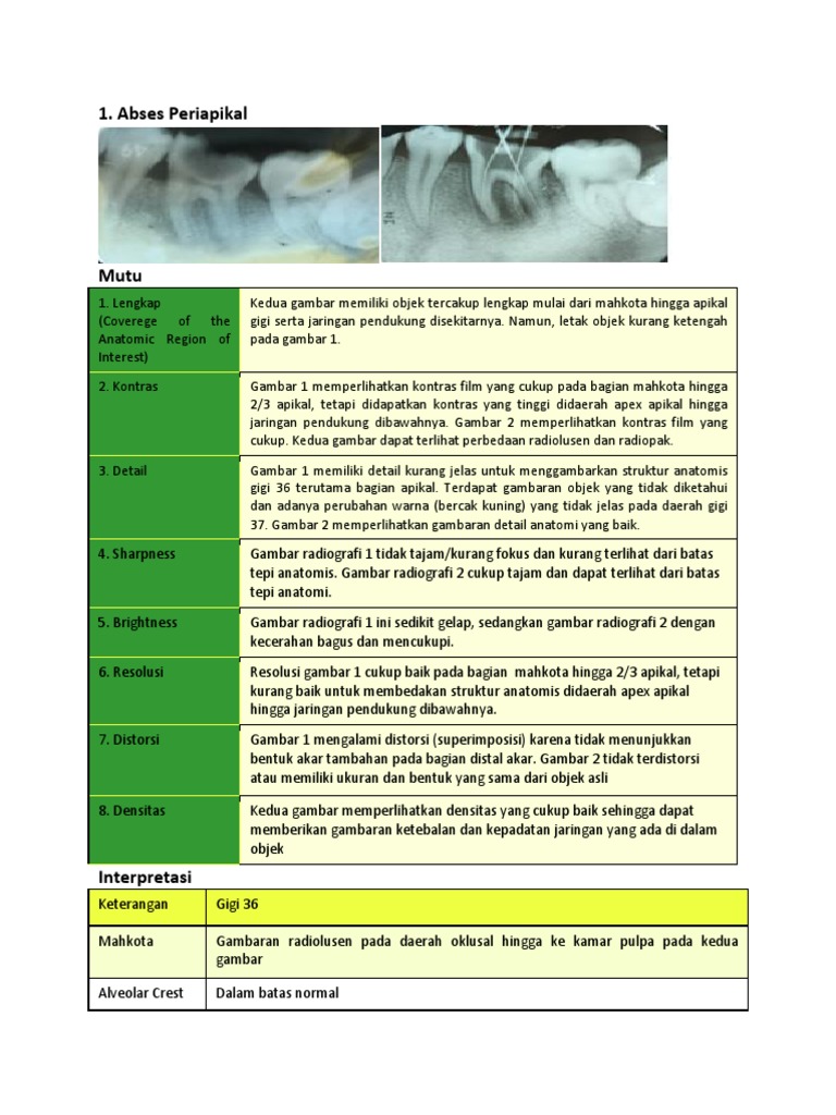 Radiografi Gigi untuk Diagnosis Abses Periapikal | PDF