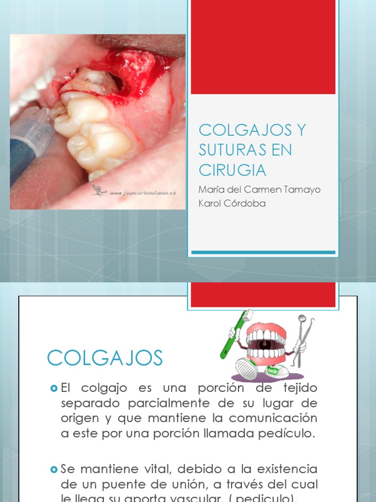 Técnicas quirúrgicas de colgajos y suturas en cirugía | PDF | Sutura Quirúrgica | Especialidades ...