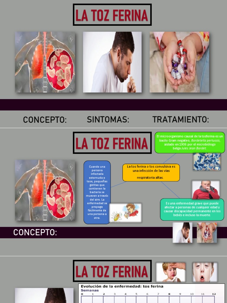 Trabajo Tos Ferina | PDF