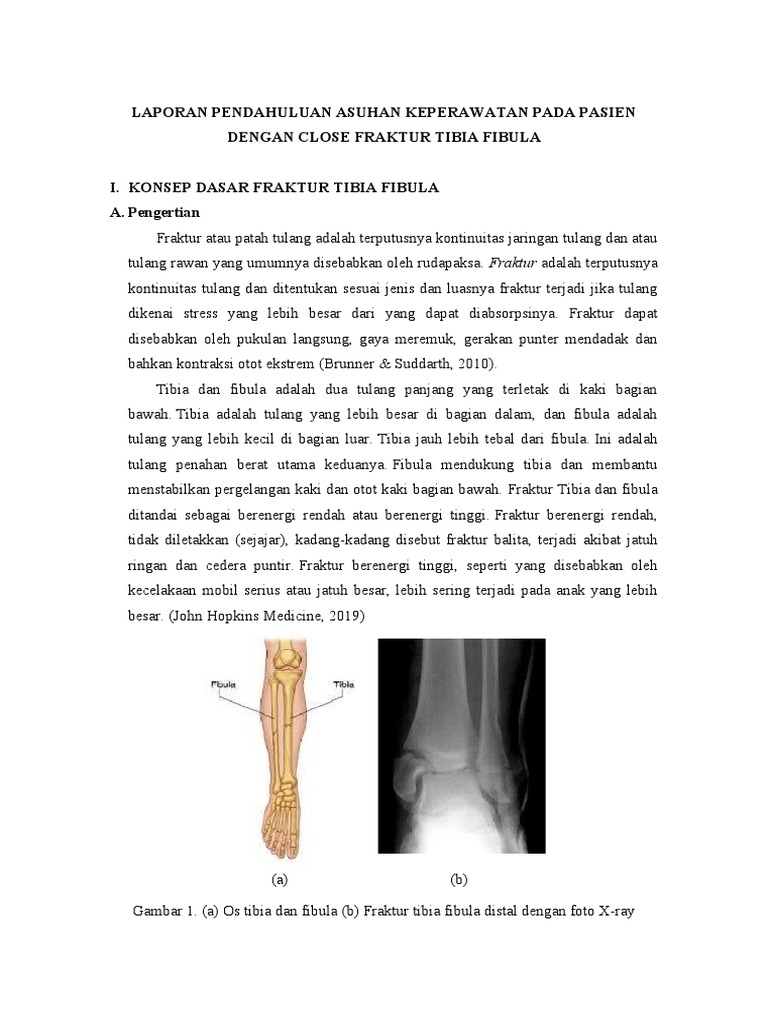 LP Close Fraktur Tibia Fibula | PDF