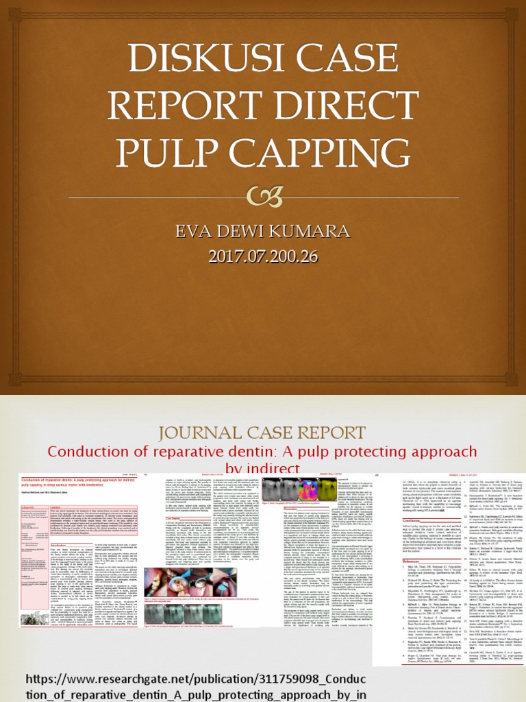 Fix Diskusi Case Report Direct Pulp Capping | PDF