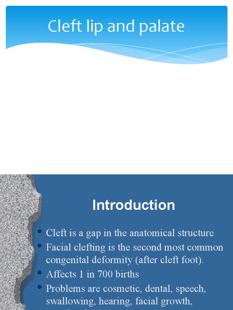 Cleft Lip and Palate | PDF | Human Nose | Human Head And Neck
