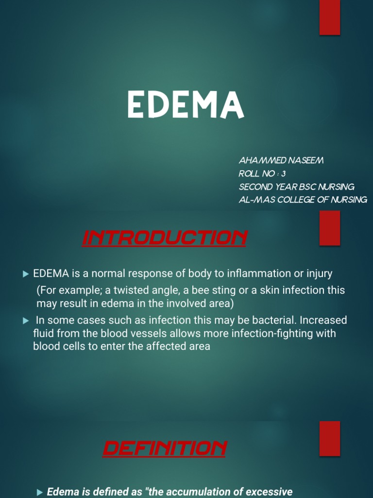 Edema: Causes, Signs, Symptoms and Treatment | PDF | Edema | Physiology