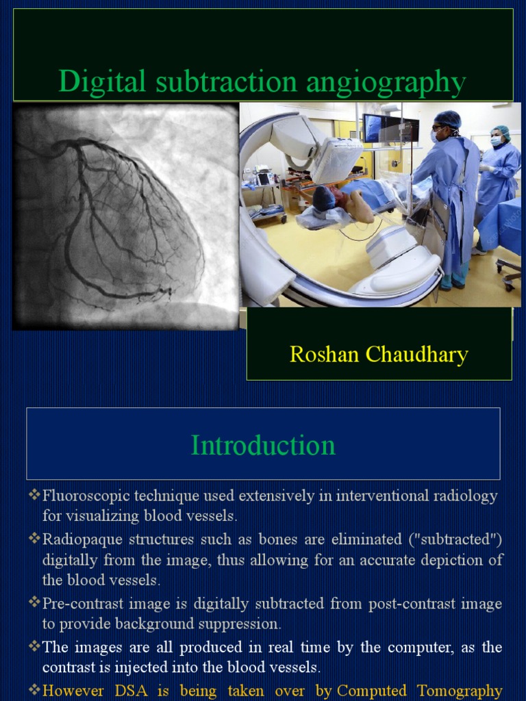 Digital Subtraction Angiography | PDF | Angiography | Medical Procedure ...