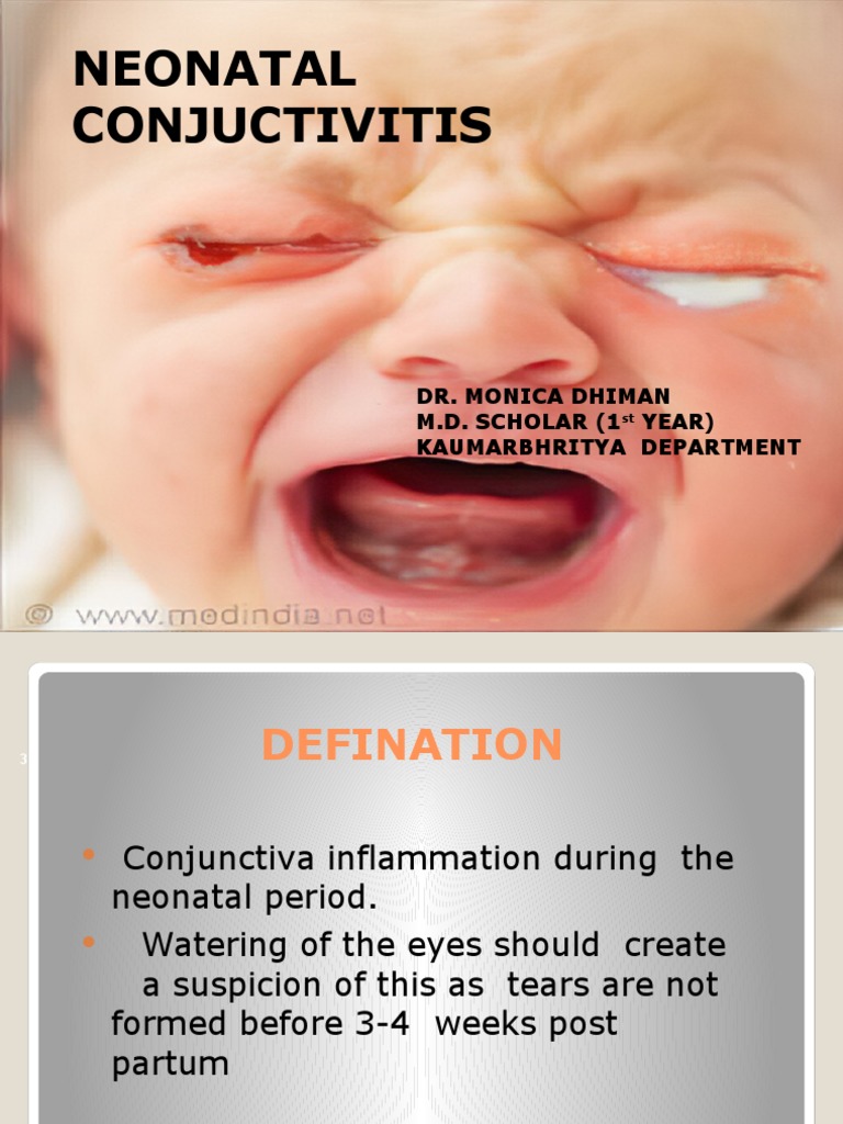 Neonatal Conjunctivitis Overview | PDF | Microbiology | Medical Specialties