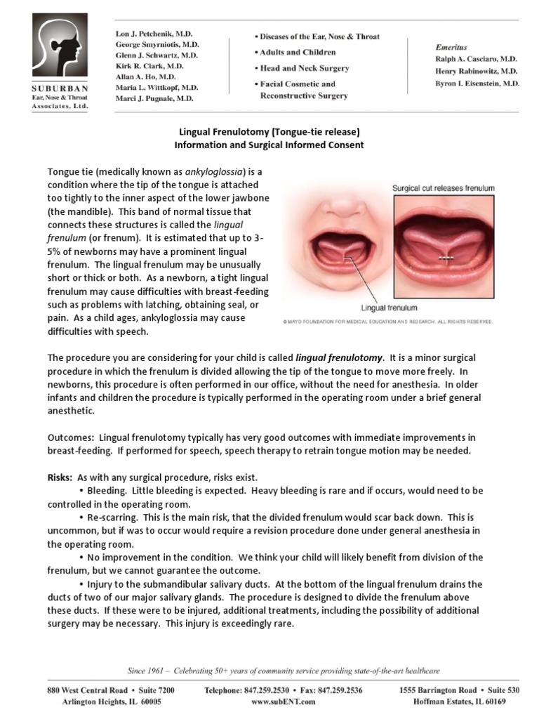 Lingual Frenulotomy Consent On Letterhead | PDF | Tongue | Medical ...