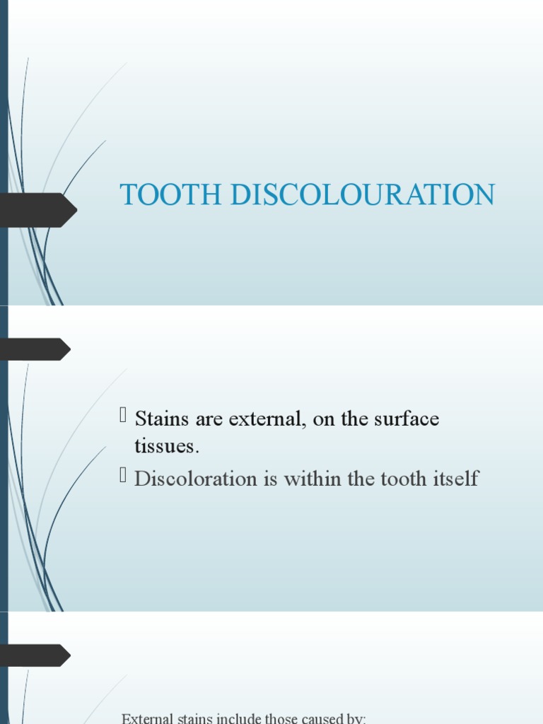 Teeth Discoloration | PDF | Human Tooth | Dentistry