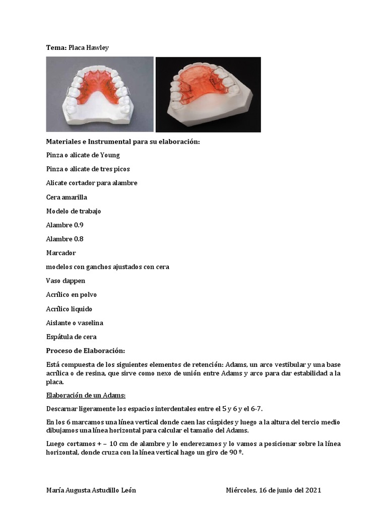 Placa Hawley | PDF | Ortodoncia | Ramas de Odontología