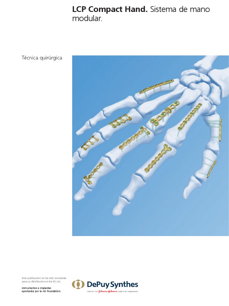 Synthes Hand | PDF | Tornillo | Mano
