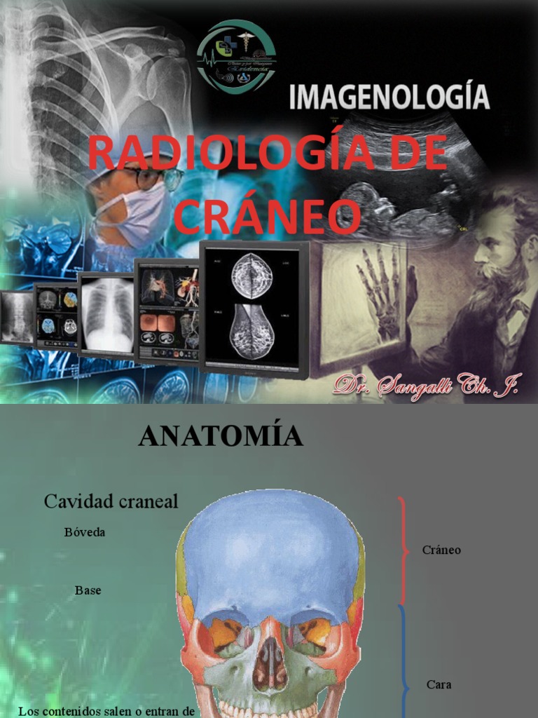 Proyecciones Radiológicas de Cráneo | PDF | Cráneo | Anatomía