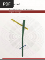 t2-st-25 Rev-1 t2 Alpha Femur-Antegrade GT Nailing System | PDF ...