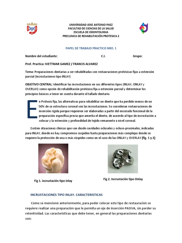 Tallado Incrustaciones Inlay | PDF | Dentadura postiza | Boca